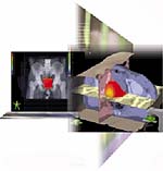 Varian Medical Systems